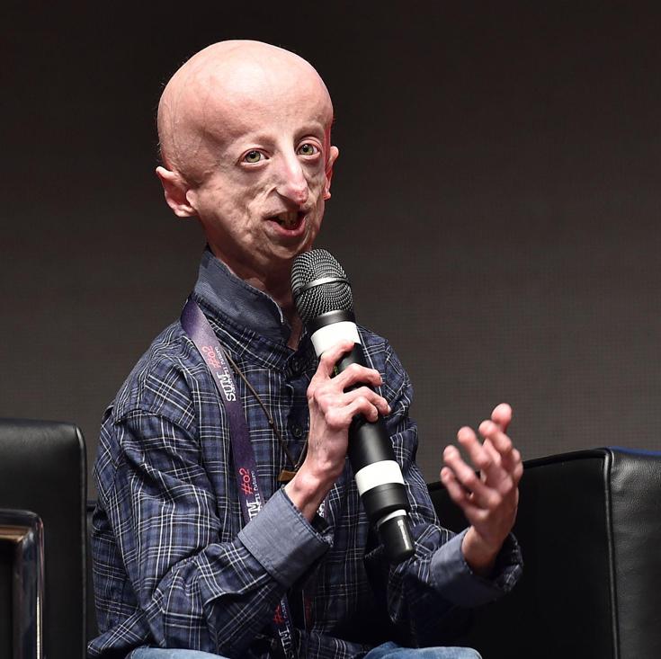 progeria sammy