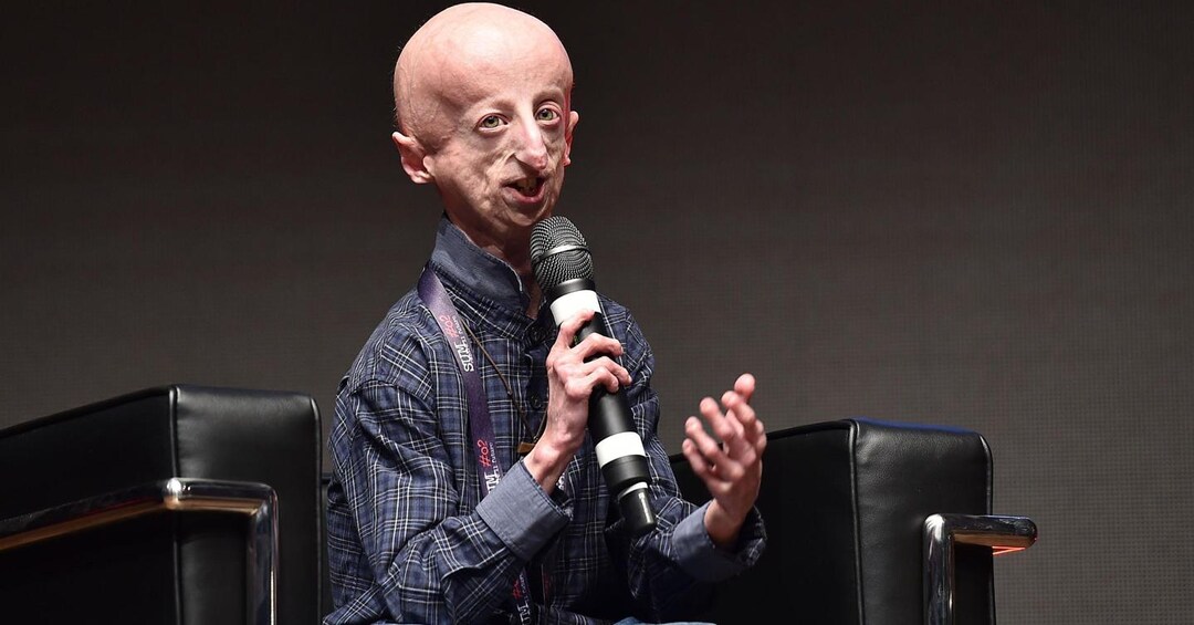 progeria interview
