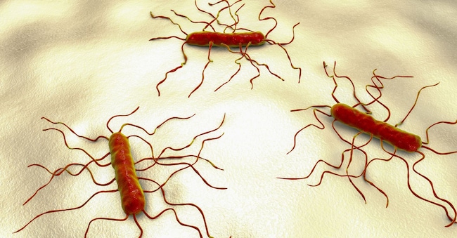 Listeria: sintomi, rischi e trattamento dell'infezione alimentare