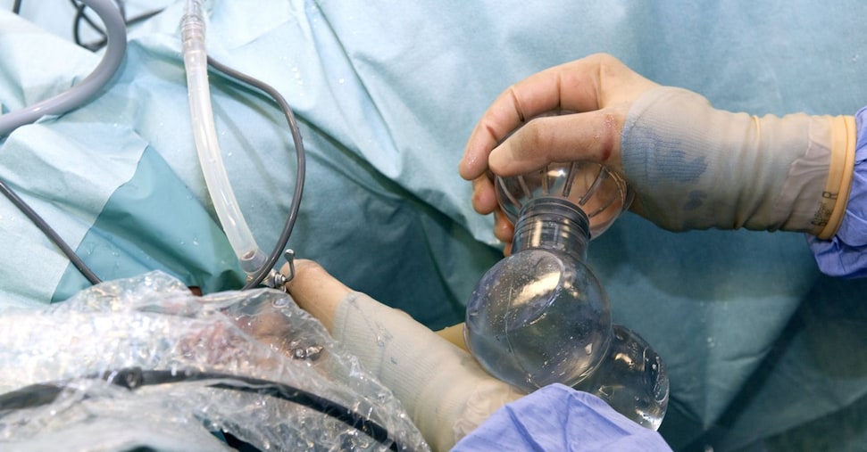 Cystoscopy: with disposable devices lower costs and more safety for ...